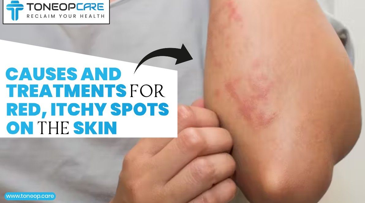 Causes & Treatments For Red, Itchy Spots On the Skin
