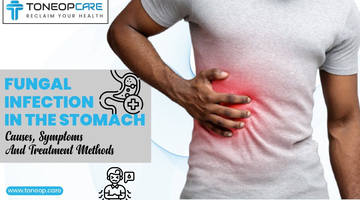 Fungal Infection In the Stomach: Causes & Symptoms