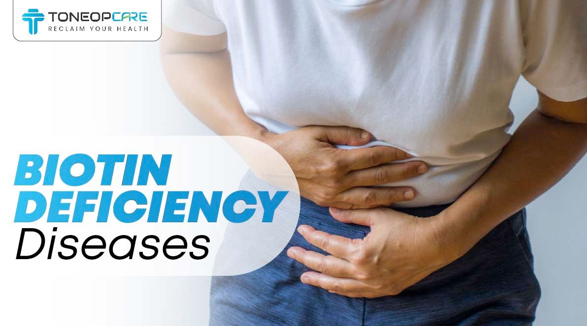 6 Surprising Biotin Deficiency Diseases | ToneOpCare