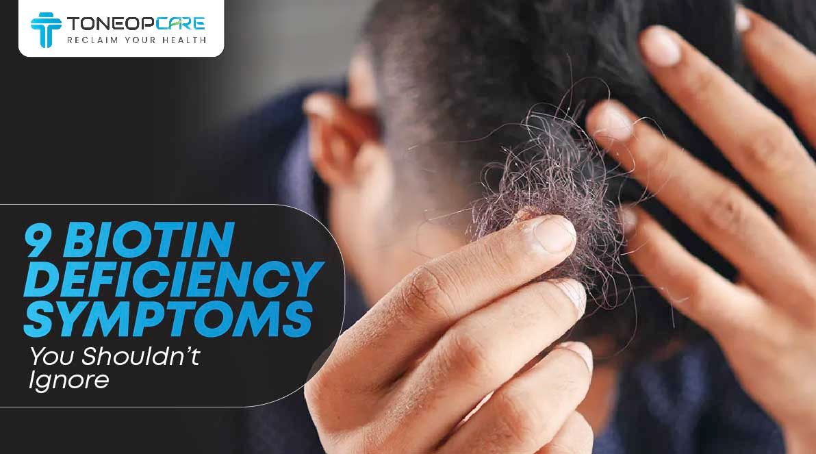 9 Biotin Deficiency Symptoms You Shouldn’t Ignore | ToneOpCare